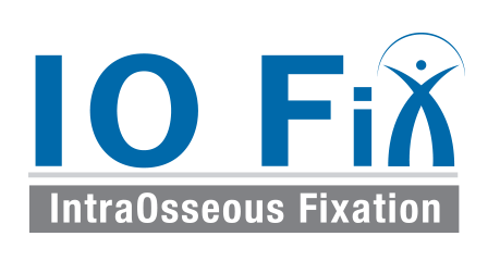 Case Studies and Publications | Extremity Medical