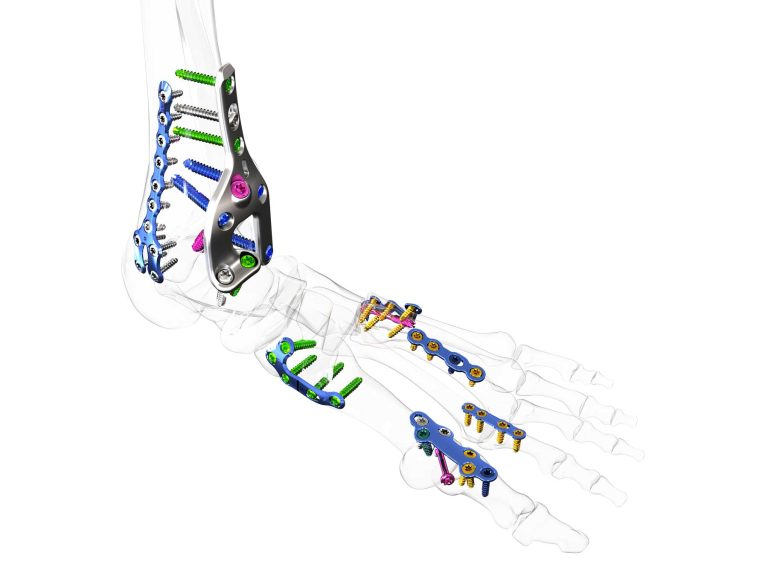 Lower Extremity | Extremity Medical