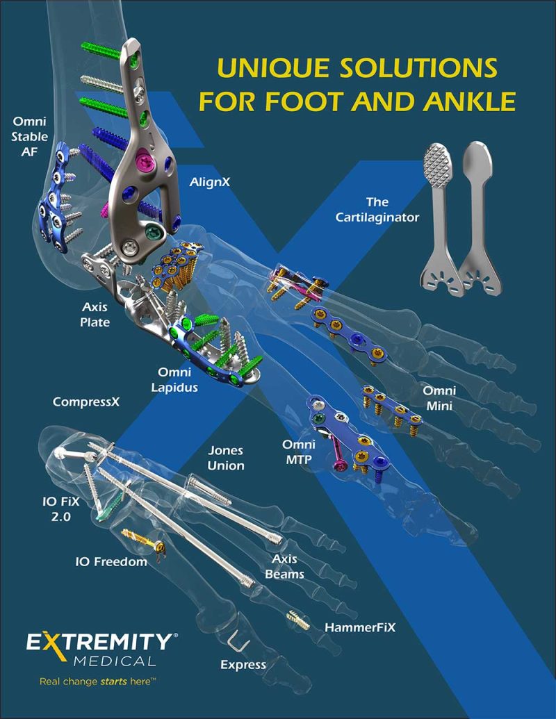 Resources | Extremity Medical